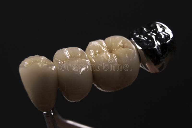 Metal ceramic stock photo. Image of light, construction - 155682654