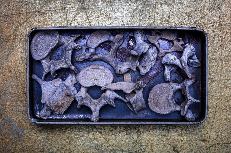 Metal Container with Human Vertebrae on an Iron Stock Photo - Image of ...