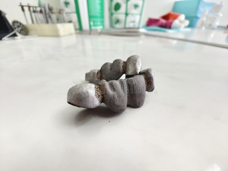 Metal Frame of a Stamped Brazed Bridge Prosthesis a on the Dental Table ...