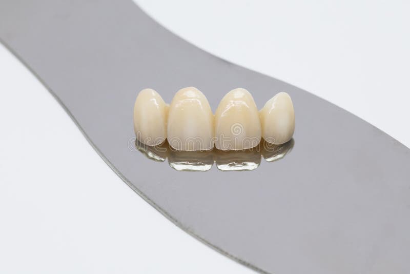 Metal Free Ceramic Dental Crowns Stock Photo - Image of detailed, craft ...