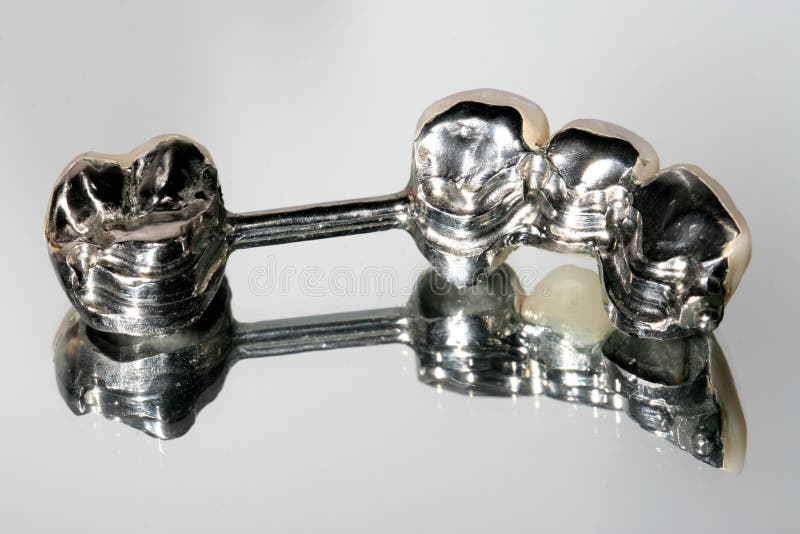 Metal teeth stock photo. Image of oral, gingival, medicine - 28494792