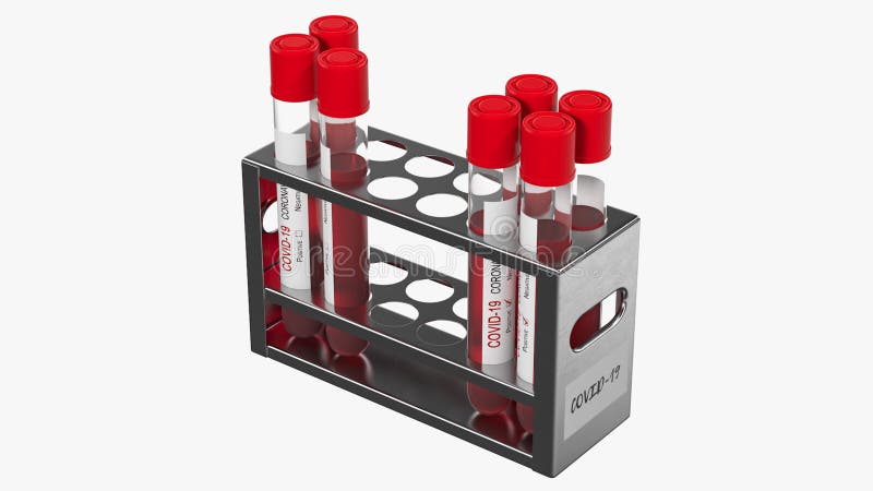 COVID Test Tube Rack with Multiple Samples Stock Photo - Image of test ...