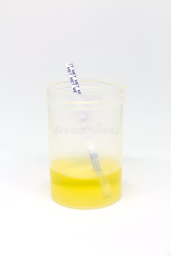 Methamphetamine test stock photo. Image of methamphetamine - 73406530
