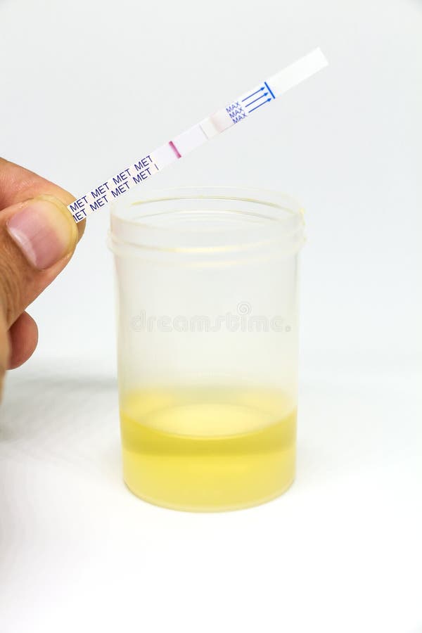Methamphetamine Test. the Result Showed Positive Stock Image - Image of ...