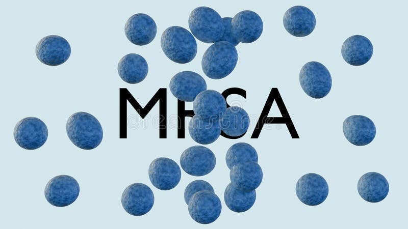 Methicillin-resistant Staphylococcus Aureus is a Type of Bacteria that ...