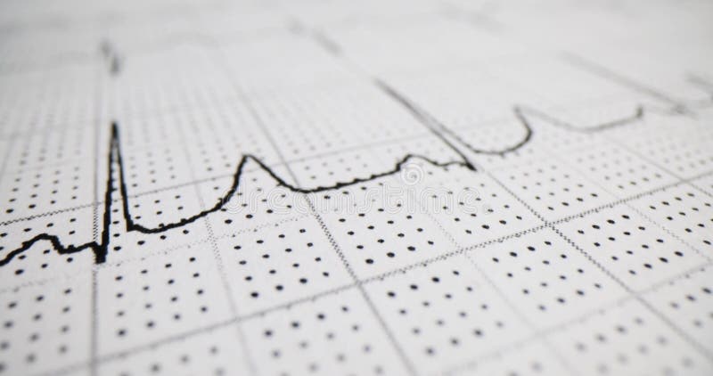 Methodology for Recording and Studying Electrical Fields Generated ...