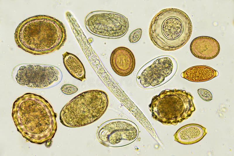 Mezclado De Helmintos En Taburete Foto de archivo - Imagen de platija ...