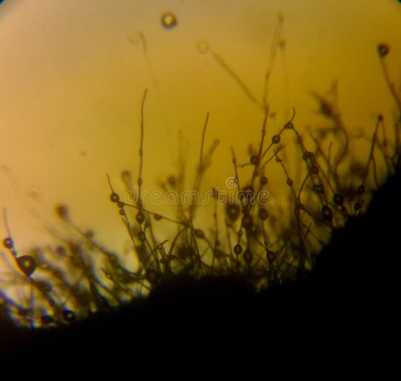 Micelio Hongo Dermatófito Bajo El Microscopio Foto de archivo - Imagen ...