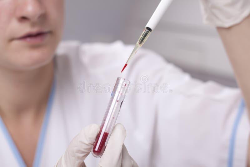 Micro pipette with blood stock image. Image of laboratory - 26061431