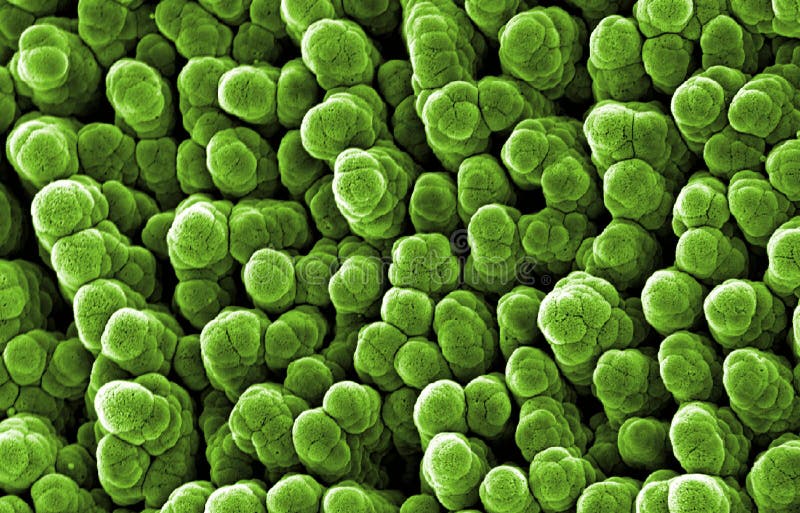 Micro-structures on Aluminum Stock Photo - Image of left, force: 87535952