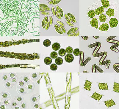 Microalgae Under Microscopic View, Green Algae, Cyanobacteria ...