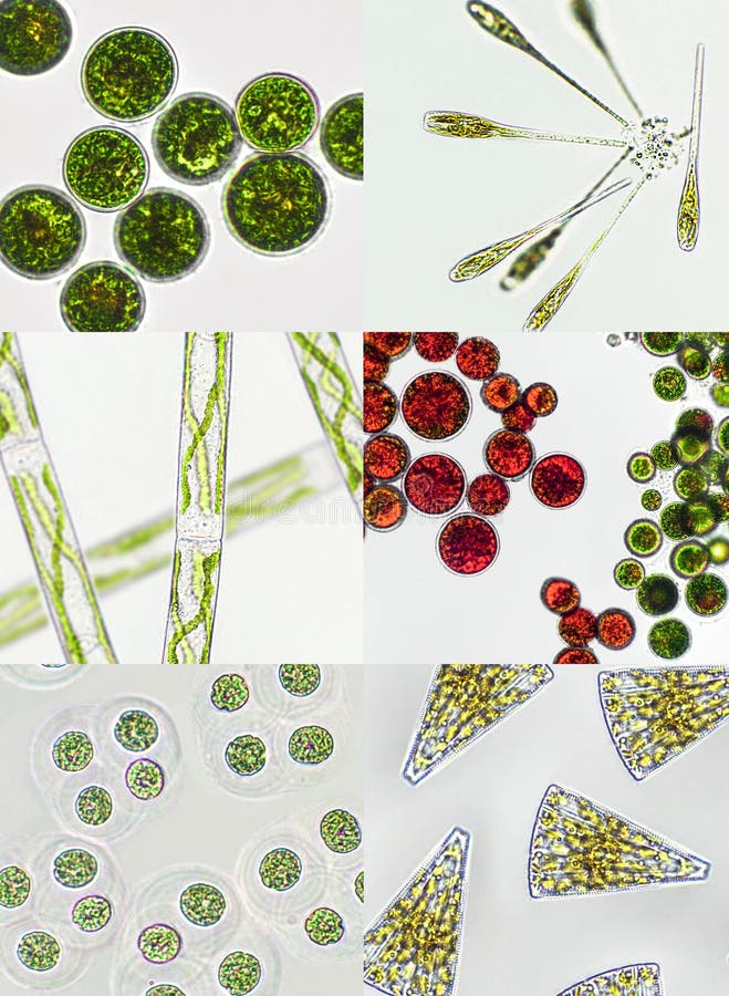 Nostoc Sp. Blue-green Algae Under Microscopic View, Cyanobacteria Stock ...
