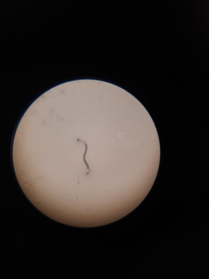 A Microbe Under the Microscope Stock Illustration - Illustration of ...