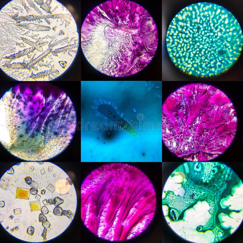 Microbes under microscope stock photo. Image of microscope - 288184018