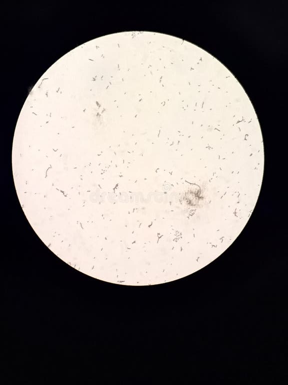 Microbes Under the Microscope Stock Image - Image of microscope ...