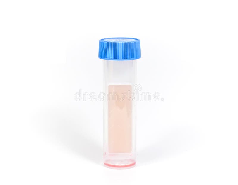 Microbial Test Kit for Laboratory Stock Photo - Image of test, fungus ...