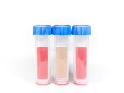 Microbial Test Kit for Laboratory Stock Photo - Image of agar ...