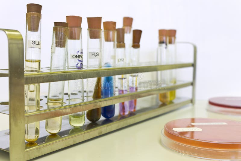 Agar In Test Tube Rack For Testing Microbiology Laboratory Stock Image ...
