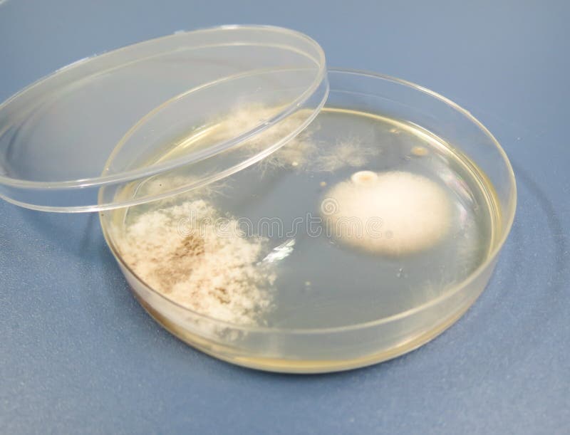 Microbiological Culture Media Stock Photo - Image of research, hand ...