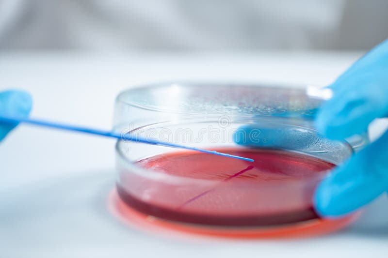 Microbiologist Inoculating Blood Agar in Petri Dish in Research Lab ...