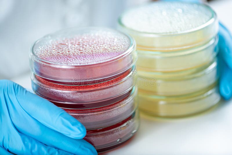 Microbiologists Bench Filled with Petri Dishes Holding Bacterial ...