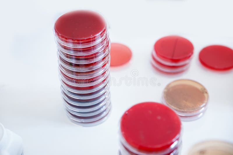 Microbiology Laboratory Agar Plate Full of Micro Bacterias and ...