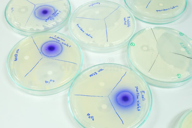 Microbiology Laboratory Test Stock Photo - Image of biotechnology, care ...