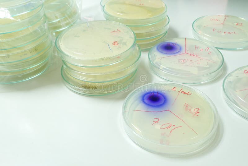 Aspergillus Mold and Yeast for Microbiology. Stock Photo - Image of ...