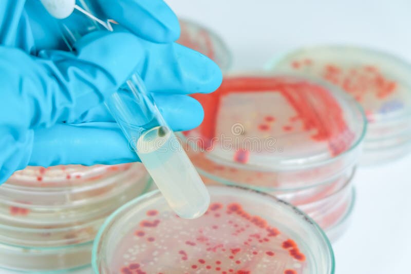 Microbiology Laboratory Test Stock Photo - Image of blue, penicillum ...