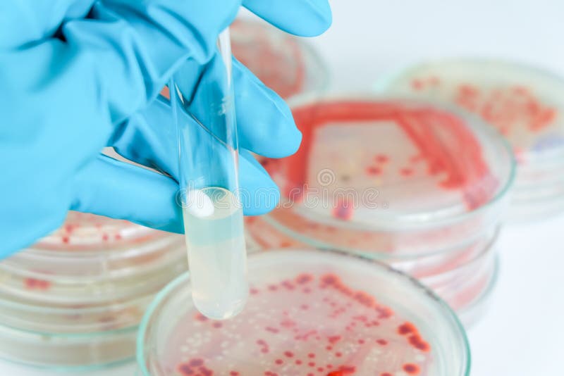 Microbiology Laboratory Test Stock Image - Image of chemical ...