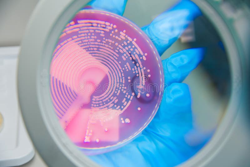 Microbiology Research in Laboratory Stock Image - Image of drug, agar ...