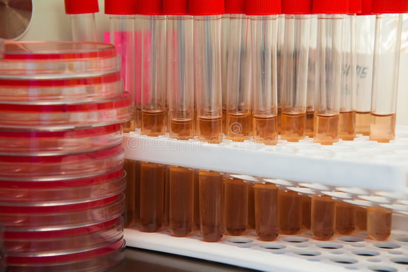 Microbiology Research in Laboratory Stock Image - Image of scientific ...