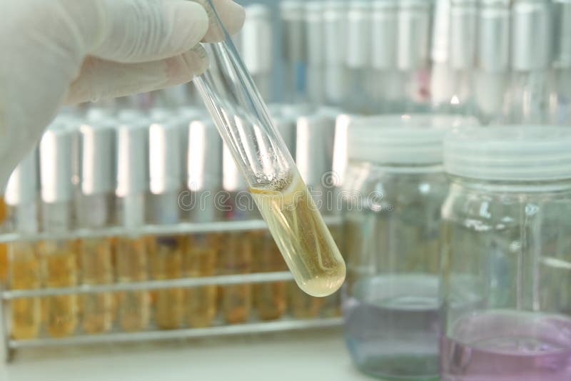 Microbiology Tool for Laboratory Test Stock Photo - Image of growth ...