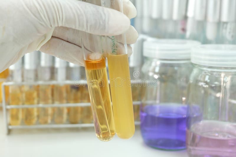 Microbiology Tool for Laboratory Test Stock Photo - Image of colony ...