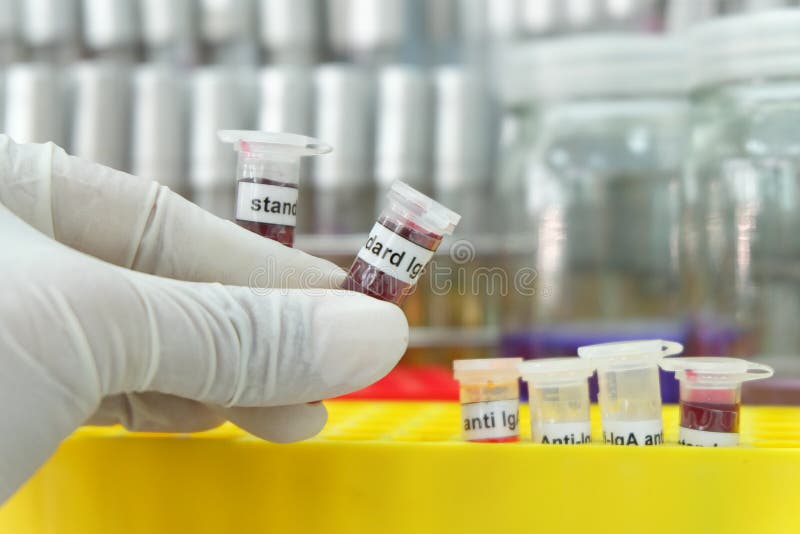 Microbiology Tool for Laboratory Test Stock Photo - Image of macro ...