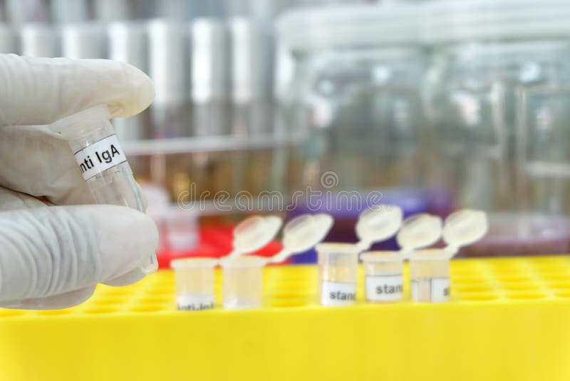 Microbiology Tool for Laboratory Test Stock Photo - Image of ...