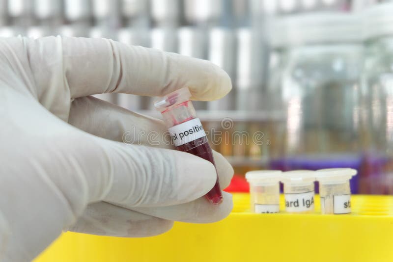 Microbiology Tool for Laboratory Test Stock Photo - Image of care, drug ...