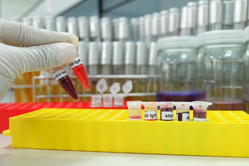 Microbiology Tool for Laboratory Test Stock Photo - Image of care ...