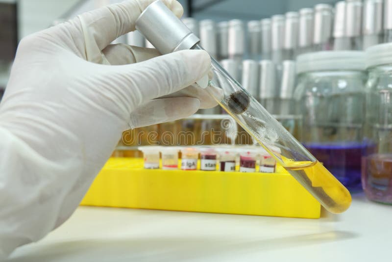 Microbiology Laboratory Test Stock Photo - Image of macro ...