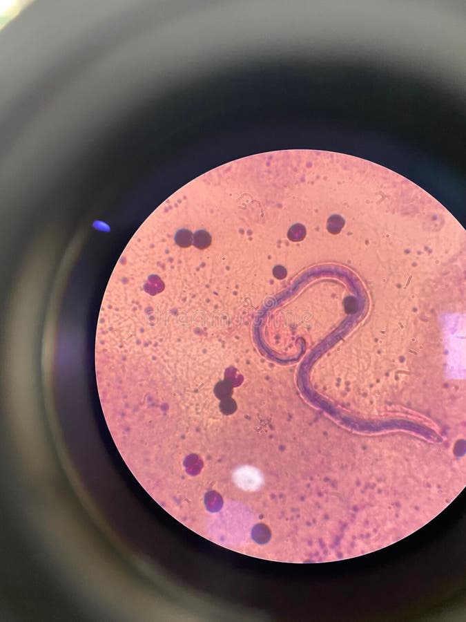 Microfilariae Wuchereria Bancrofti Appearance Stock Photos - Free ...