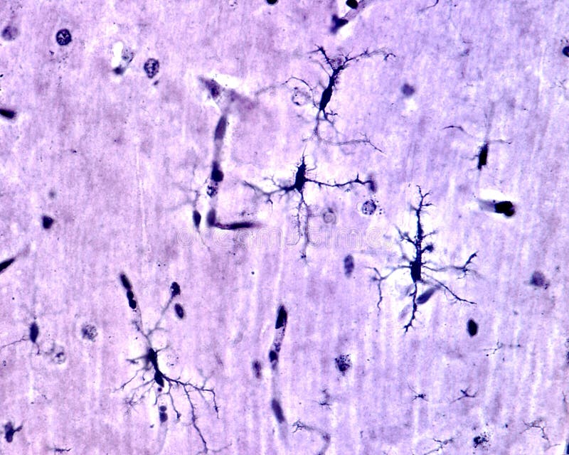 Hortega's Method Stock Photos - Free & Royalty-Free Stock Photos from ...