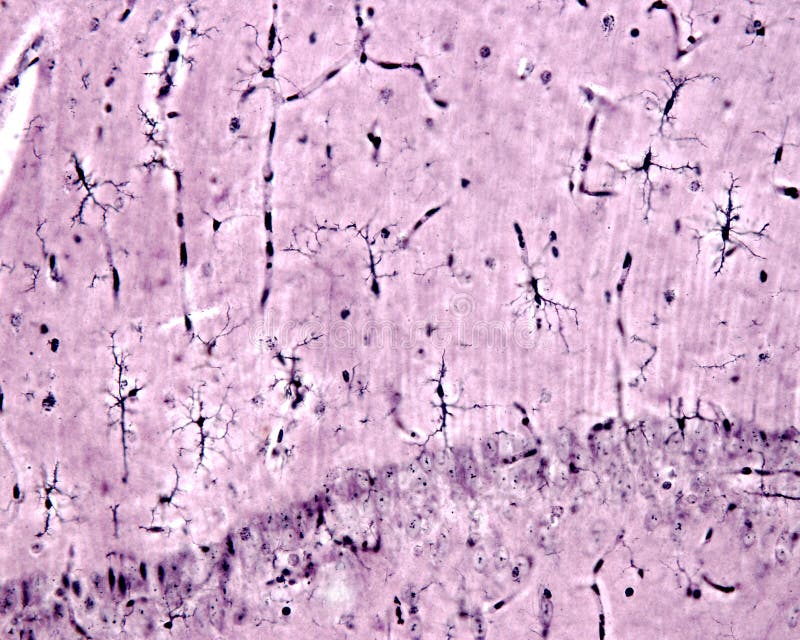Microglia Hipocampo imagem de stock. Imagem de biologia - 117240481