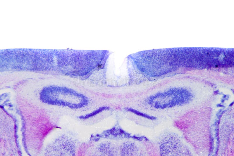Micrográfo Del Cerebro De La Rata Imagen de archivo - Imagen de ...