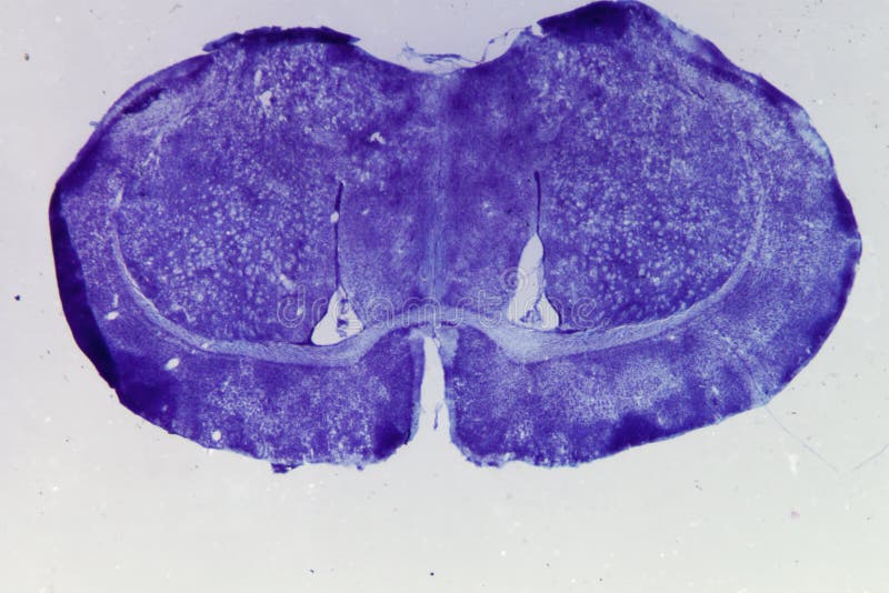 Micrográfo Del Cerebro De La Rata Imagen de archivo - Imagen de ...