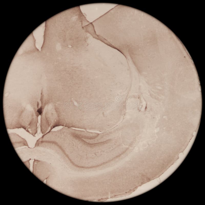 Micrográfo Del Cerebro De La Rata Imagen de archivo - Imagen de ...