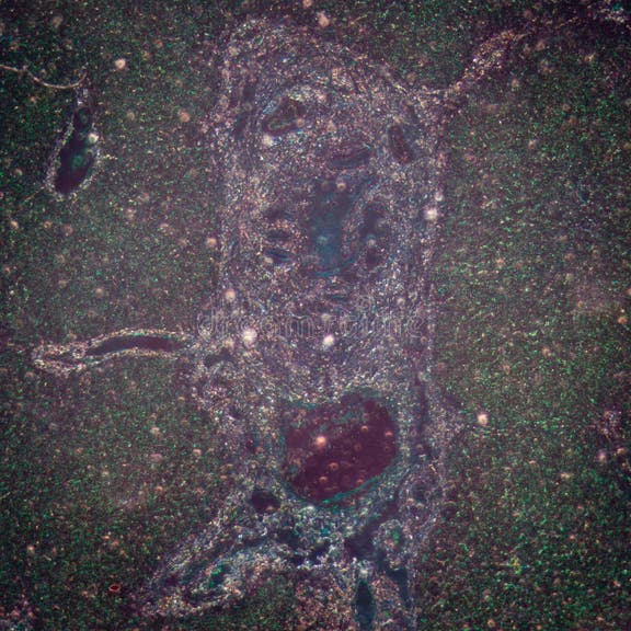 Micrograph of liver tissue stock photo. Image of macro - 25705068