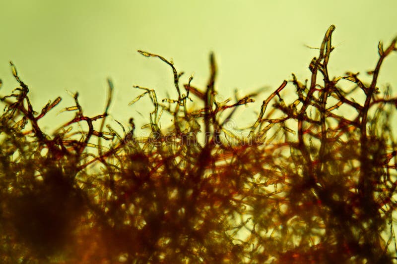 Micrograph of Moss Rhizoids, Aulacomnium Palustre, with Polarization at ...