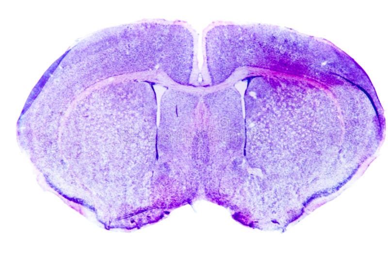 Micrograph of rat brain stock image. Image of material - 37007793