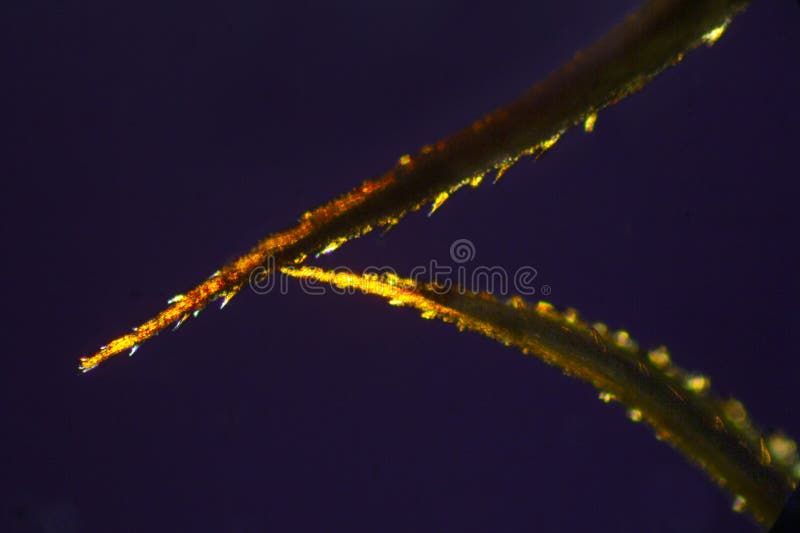 Micrograph of Serrate Moss Leaf Tips with Polarization at 40x Stock ...