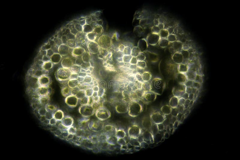 Micrograph of a Seta Cross Section in Polytrichum Moss. Stock Photo ...